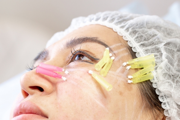 Eye Threads - Product effectively addressing periorbital issues